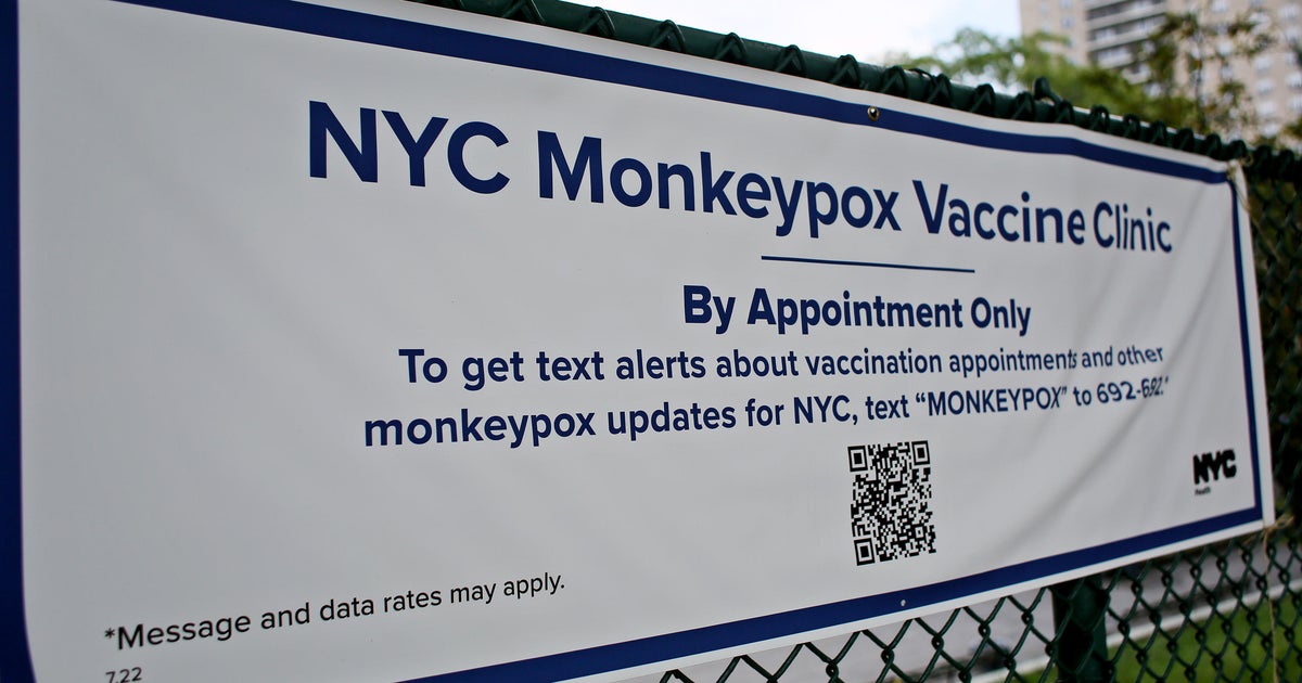 New York City will start offering 2nd dose of monkeypox vaccine - CBS ...