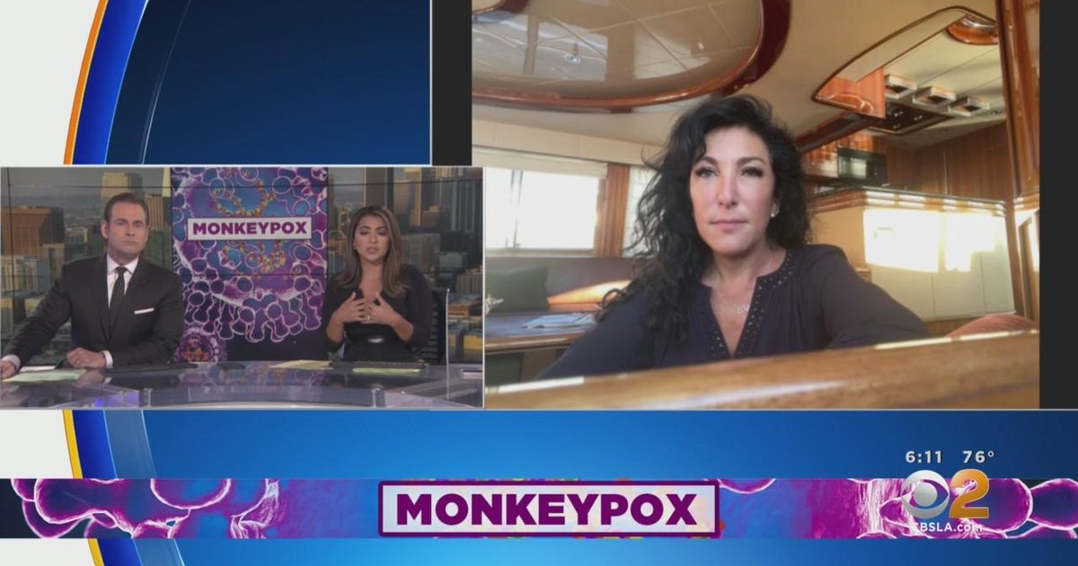 Monkeypox cases double in Los Angeles County; find out what medical ...