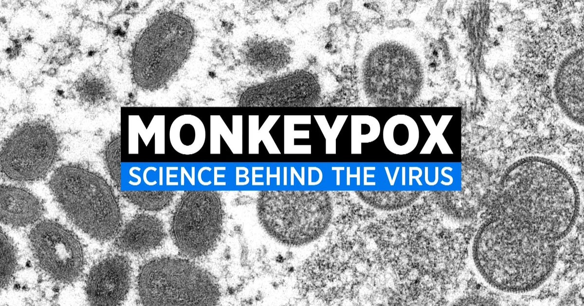 Everything you need to know about monkeypox - CBS Chicago