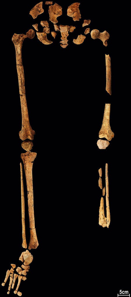 Stone Age skeleton's missing foot likely evidence of prehistoric ...