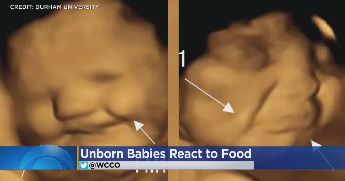 Photos show fetuses reacting to food in utero - CBS Minnesota