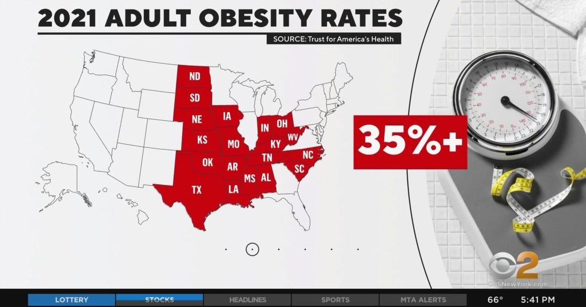 Experts alarmed by rising obesity rates - CBS New York