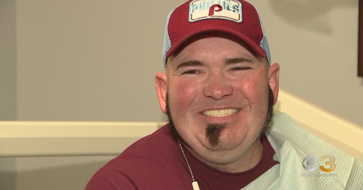 Philadelphia man gets new free smile following car accident - CBS ...