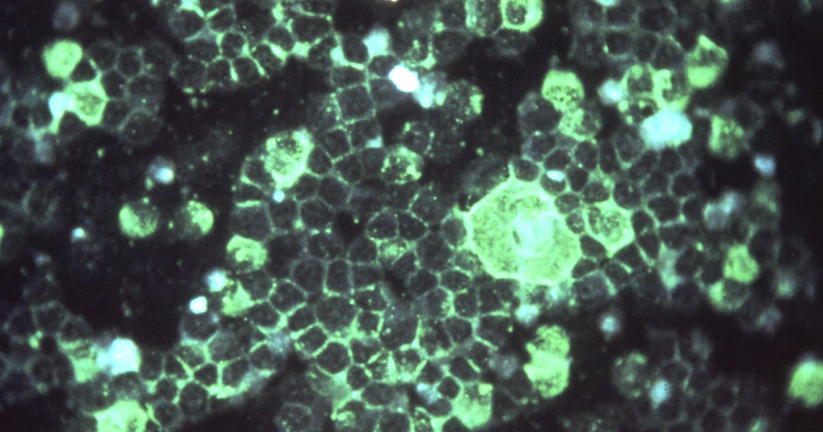 An 'unprecedented' rise in respiratory viruses in children is ...