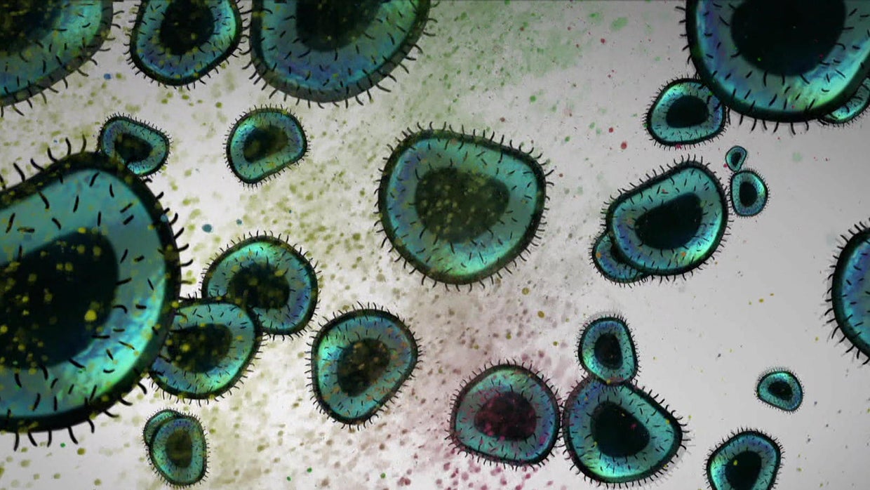 How an experimental treatment beat a little girl's cancer - CBS News