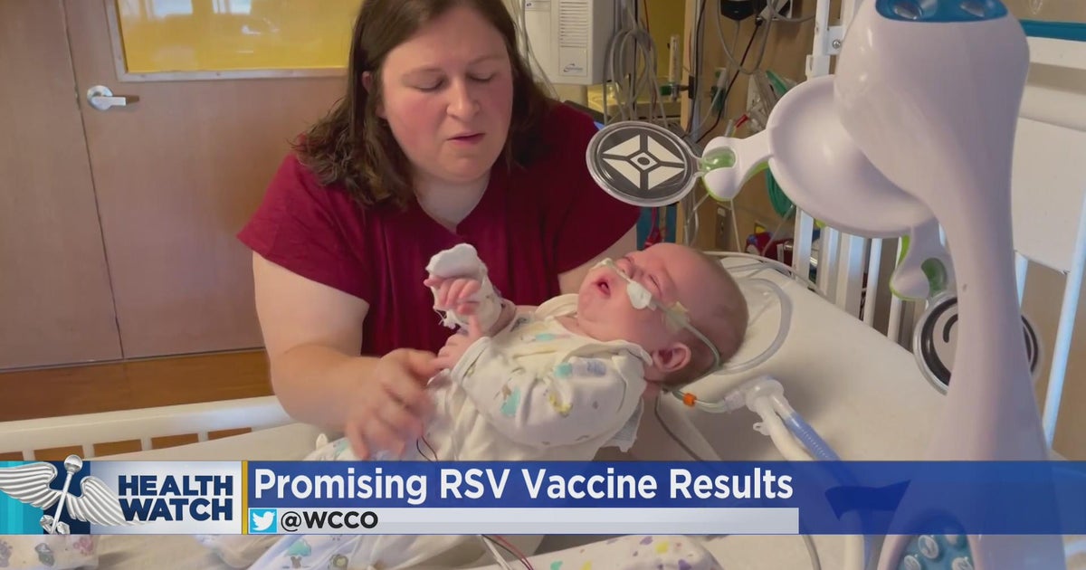 New vaccine could protect babies from RSV - CBS Minnesota