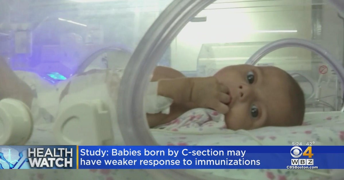 Study: Babies born by C-section may have weaker response to ...