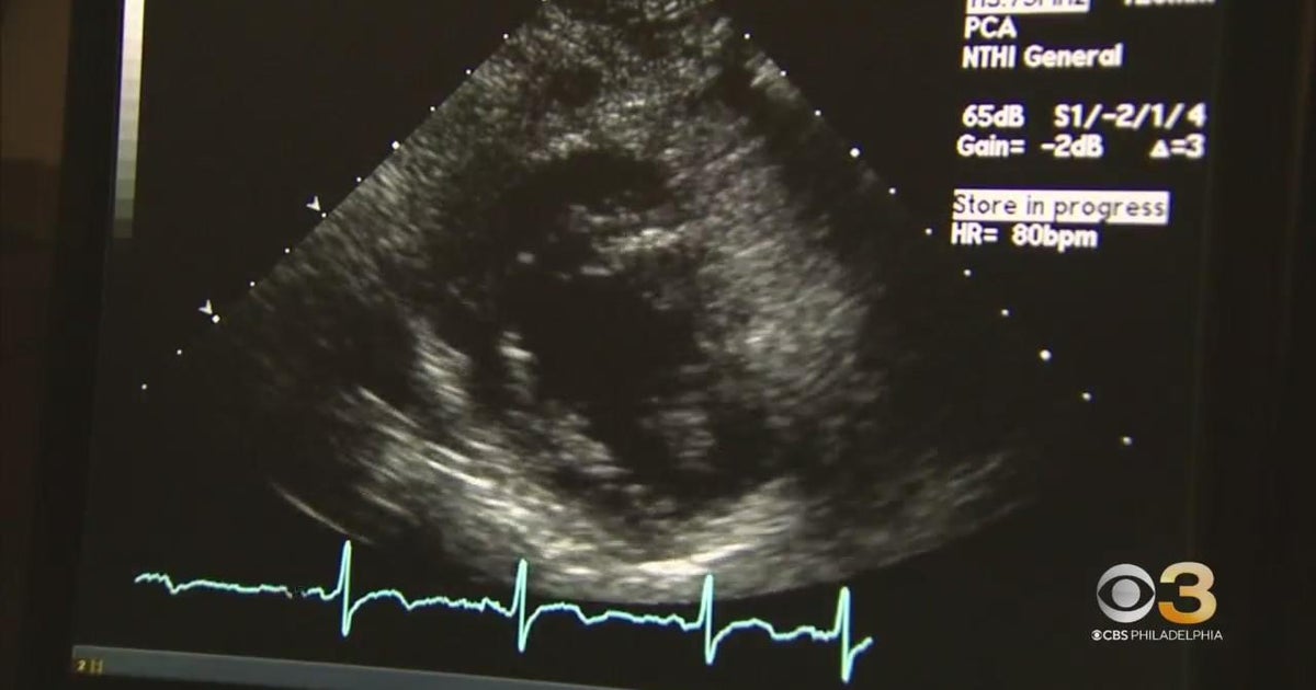 Philly Heart Walk returns this weekend, raising awareness about heart ...