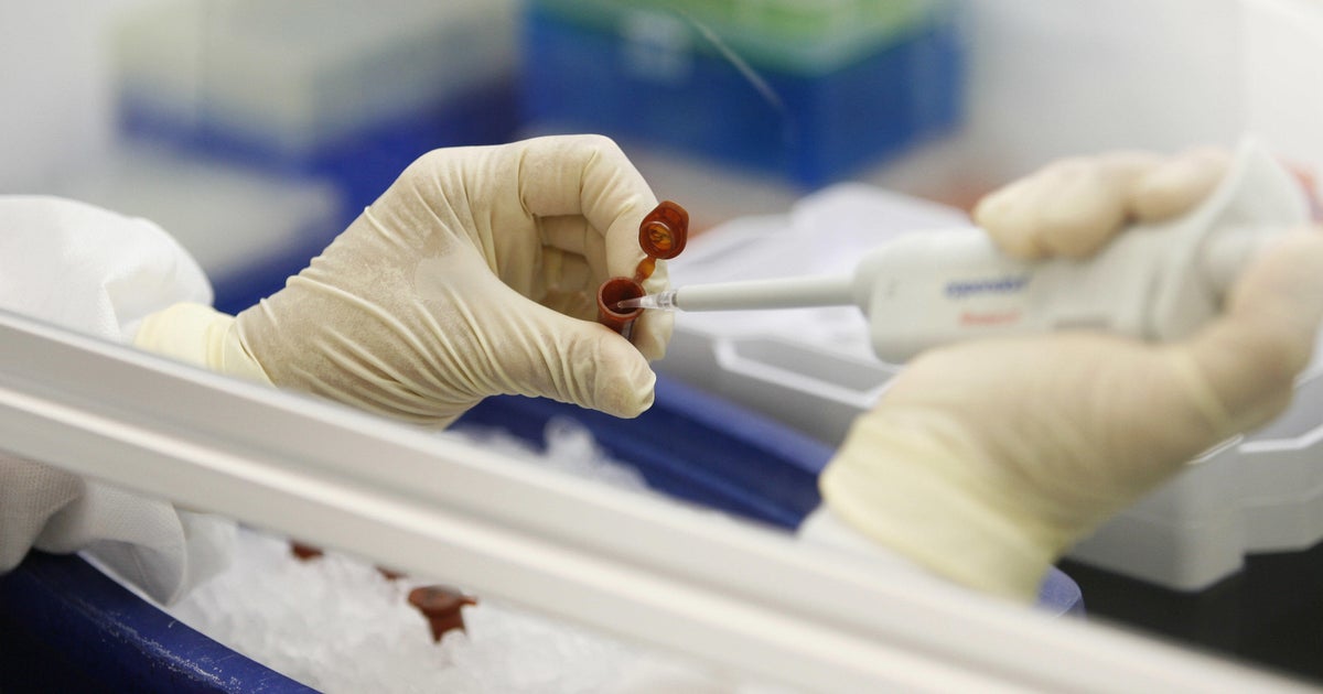 Santa Clara County announces first flu death of the season - CBS San ...