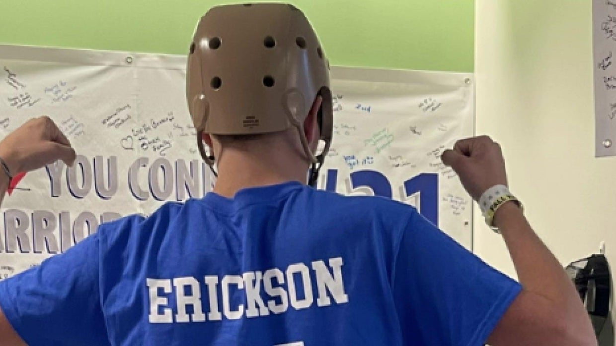 "It was breathtaking": Conner Erickson gets hero's welcome after months ...