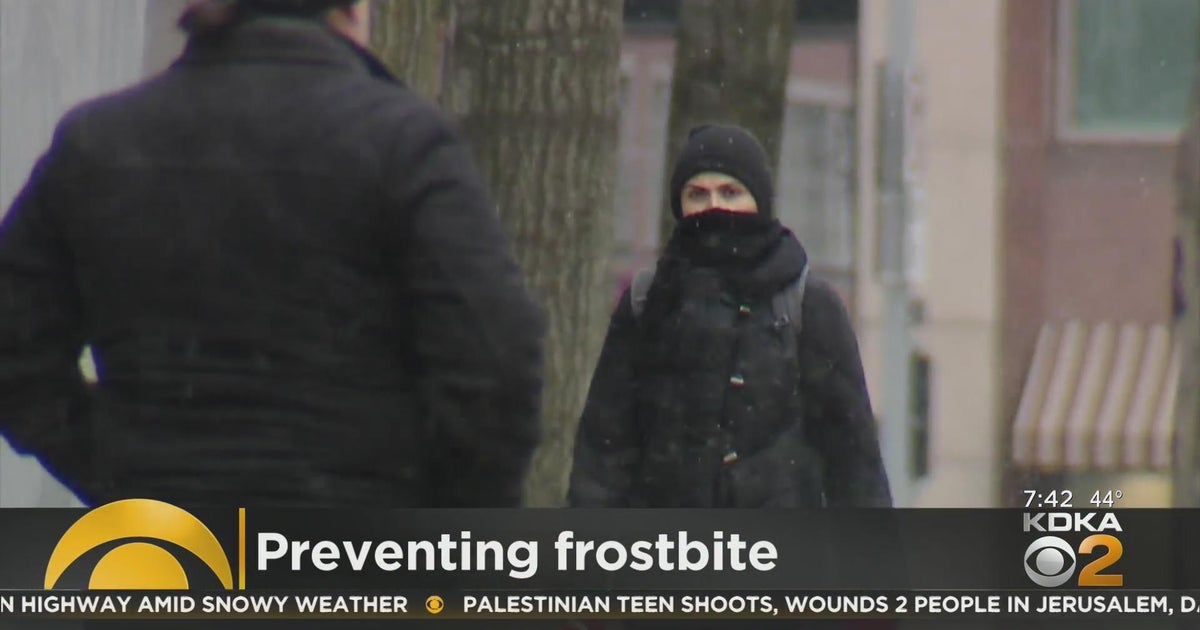 How to prevent frostbite - CBS Pittsburgh