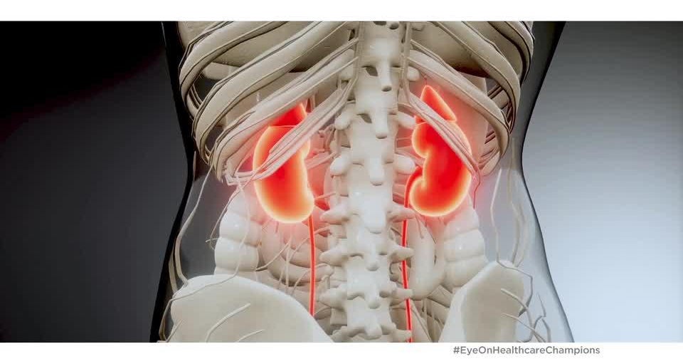 Living heroes, living donors gift life to kidney transplant patients ...