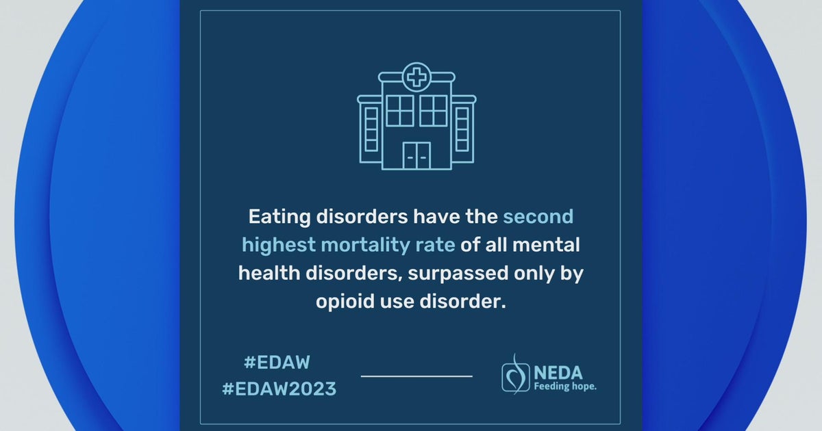 Where to find help if struggling with eating disorder - CBS Minnesota
