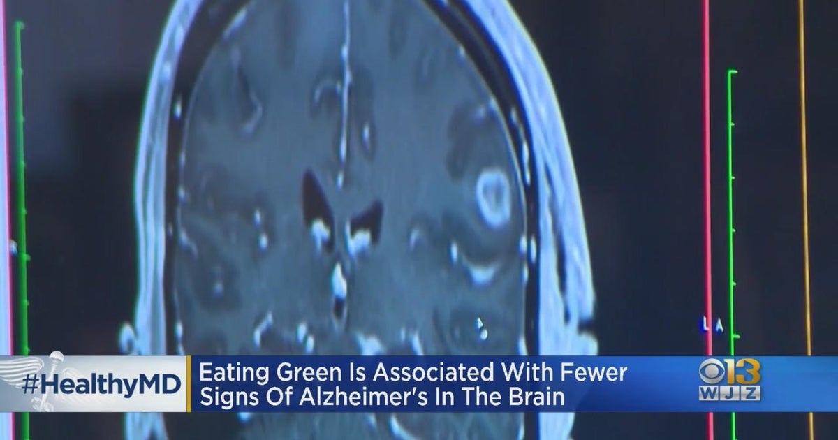 HealthWatch: Eating green is associated with fewer signs of Alzheimer's ...
