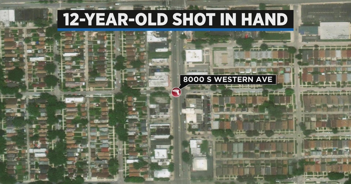 Boy, 12, accidentally shoots himself inside car on South Side - CBS Chicago