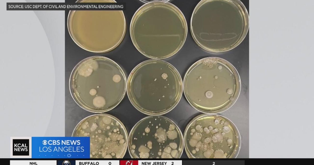 USC scientists find antibiotic-resistant bacteria growing in LA's ...