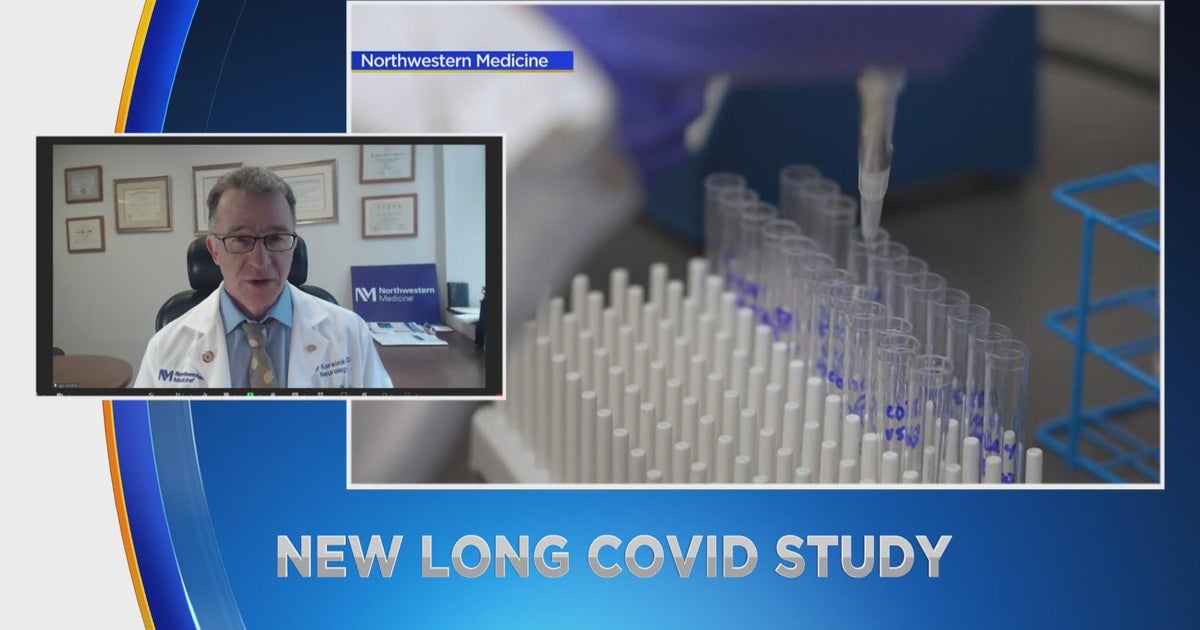 Long COVID study reveals difference in symptoms based on severity of first infection - CBS Chicago