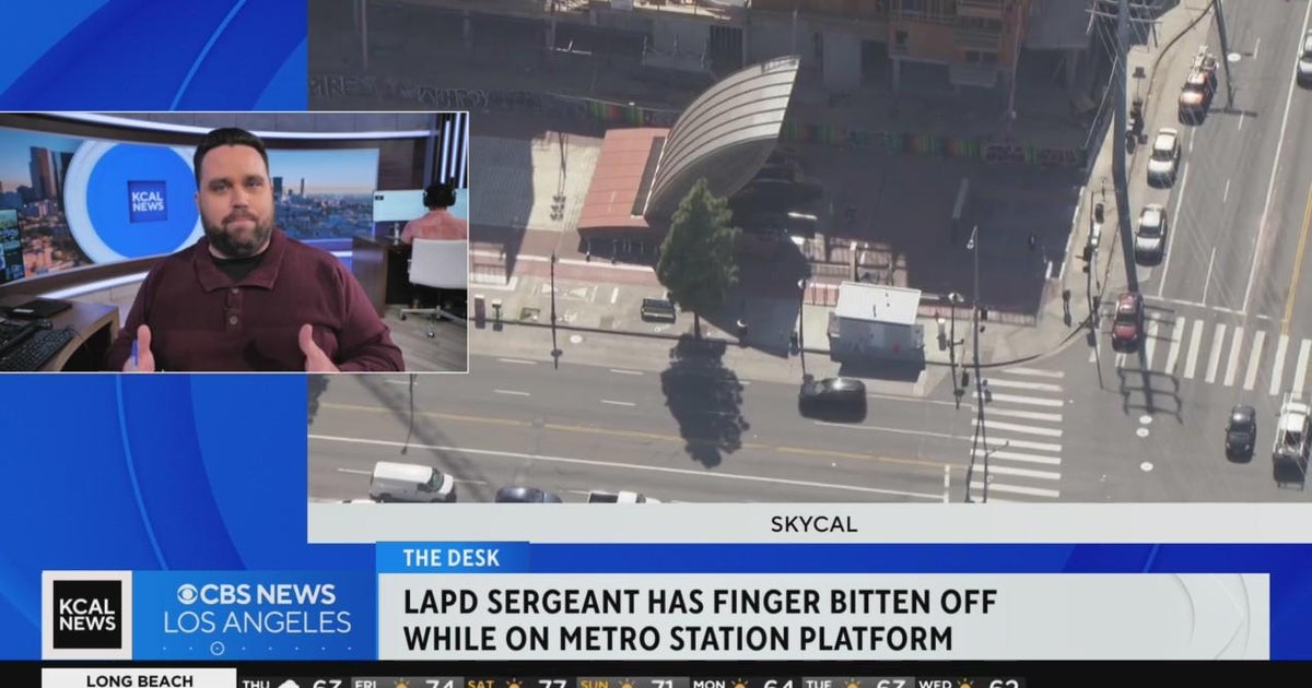 LAPD sergeant hospitalized after having finger bitten off at Metro ...