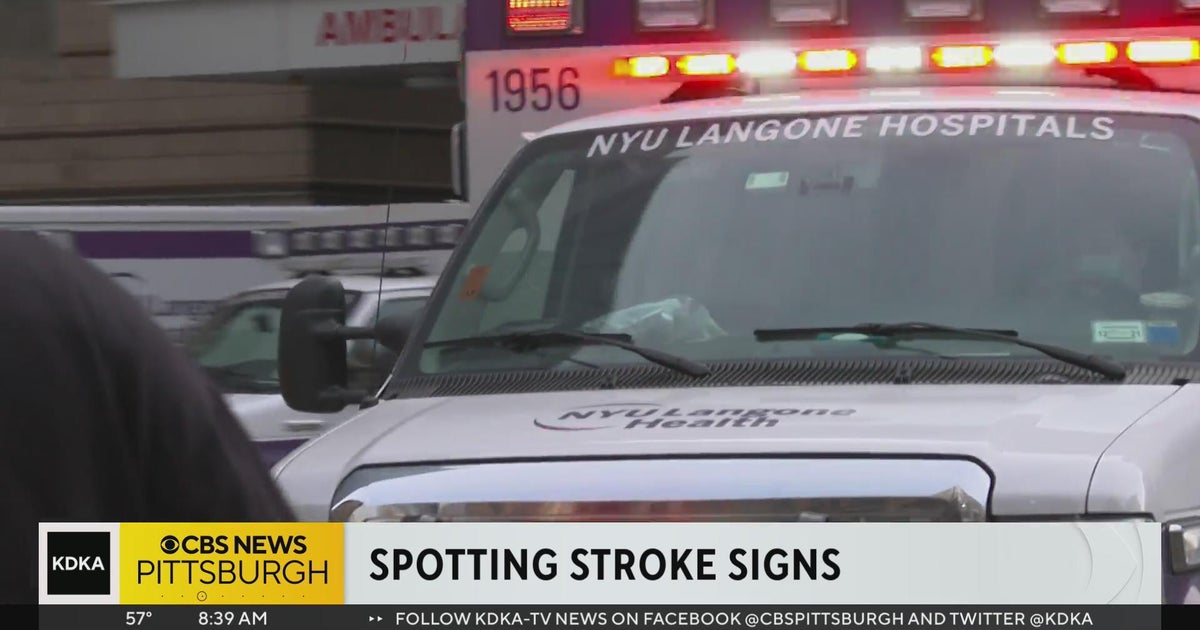 How to spot stroke signs - CBS Pittsburgh