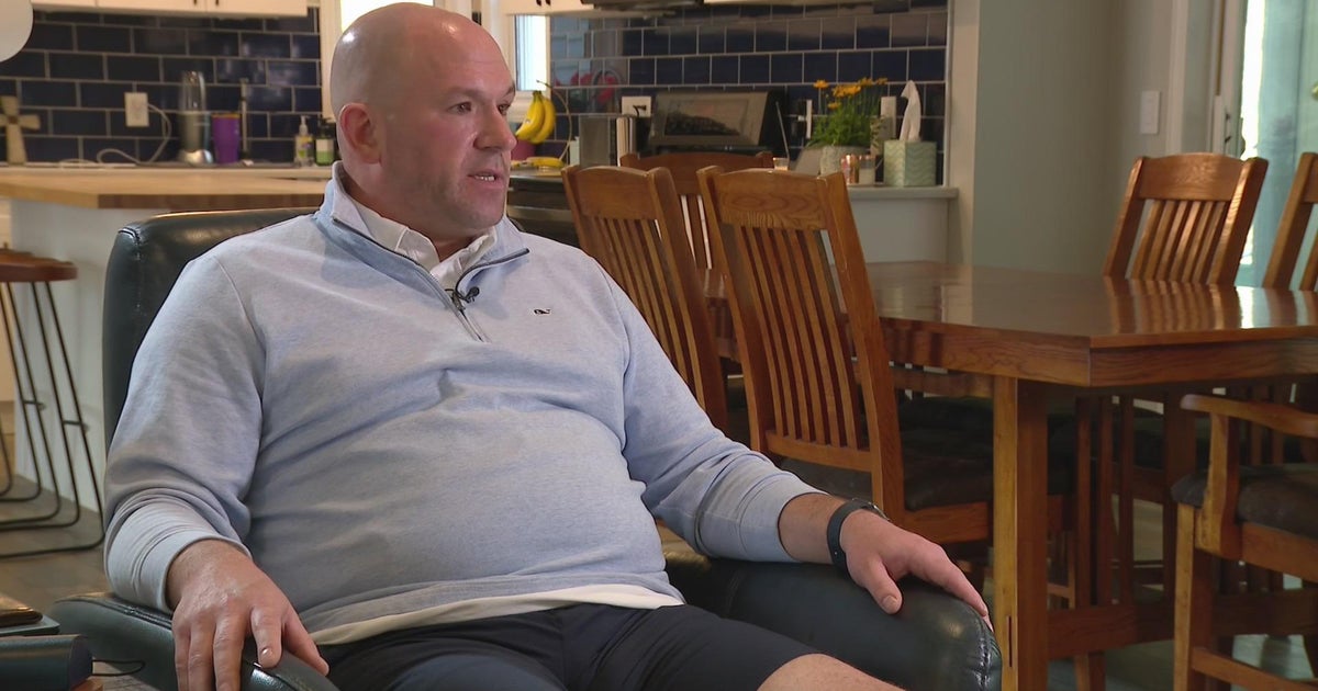 Eagan hit-and-run victim credits Apple Watch for helping save his life - CBS Minnesota