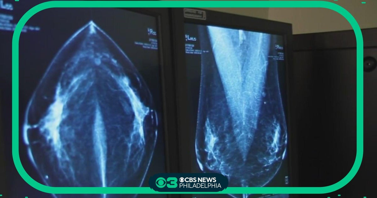 Breast Cancer Screening Guidelines U S Agency Revises Recommendations