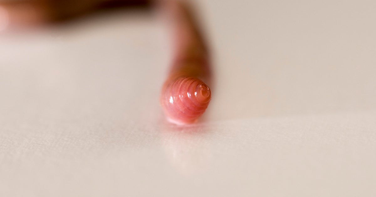 NWS Twin Cities issues "worm warning" - CBS Minnesota