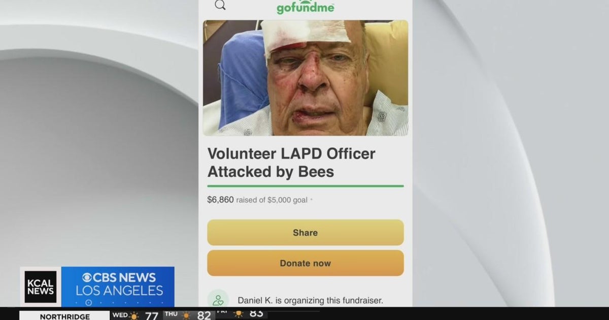 LAPD volunteer swarmed by bees, stuck with huge medical bills - CBS Los Angeles