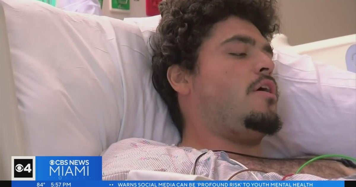 Florida man loses arm to gator bite - CBS Miami