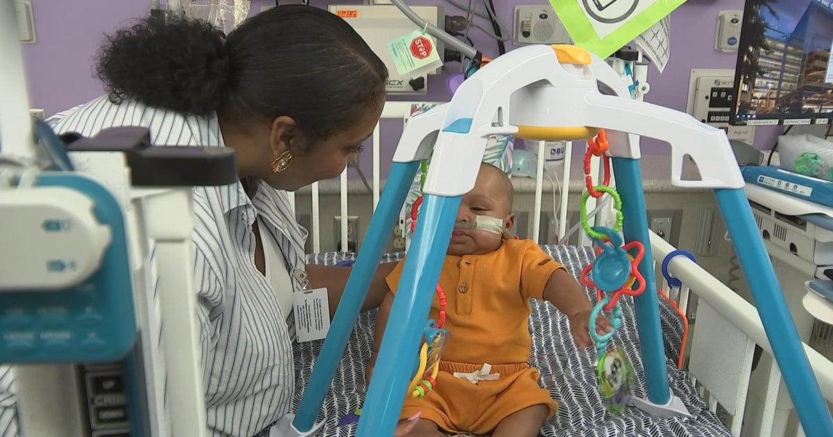 Philadelphia baby receives world's smallest pacemaker - CBS Philadelphia