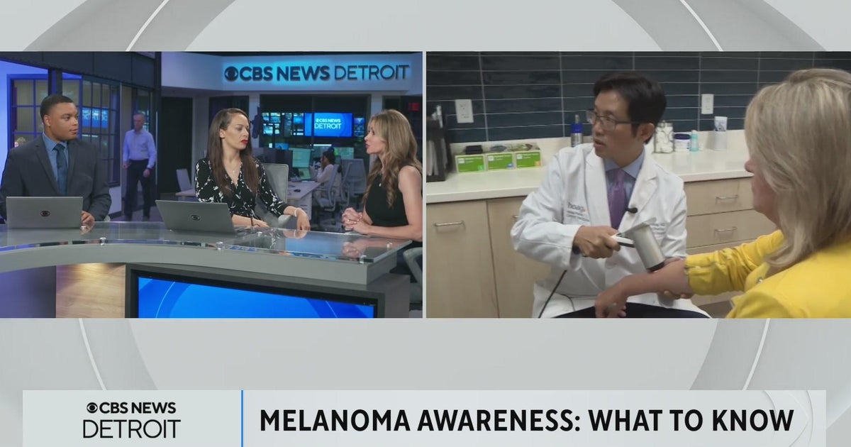 Melanoma awareness: What to know and what to look for - CBS Detroit