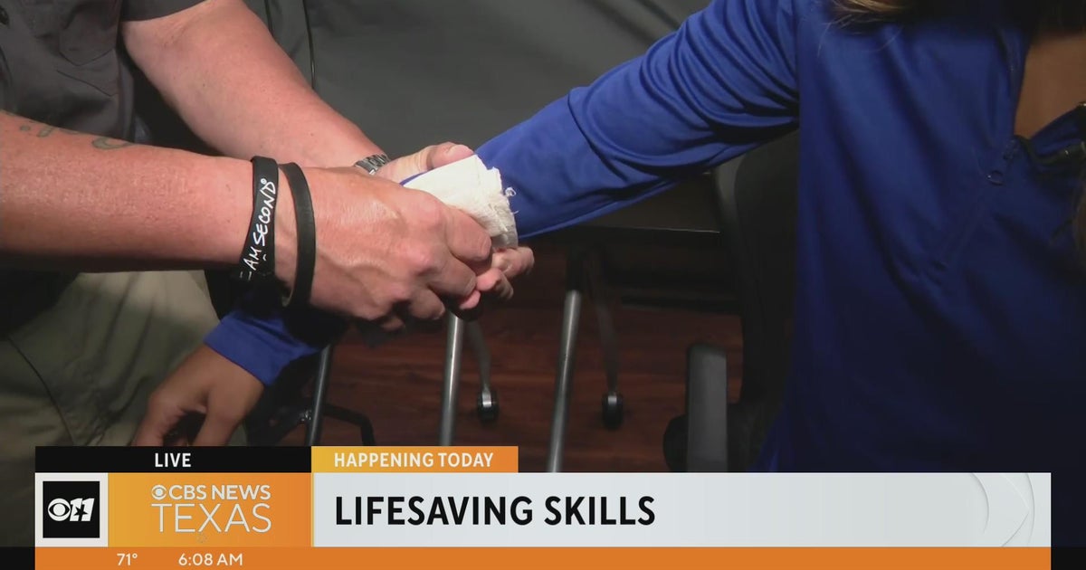 Here's what to do when someone is bleeding excessively - CBS Texas