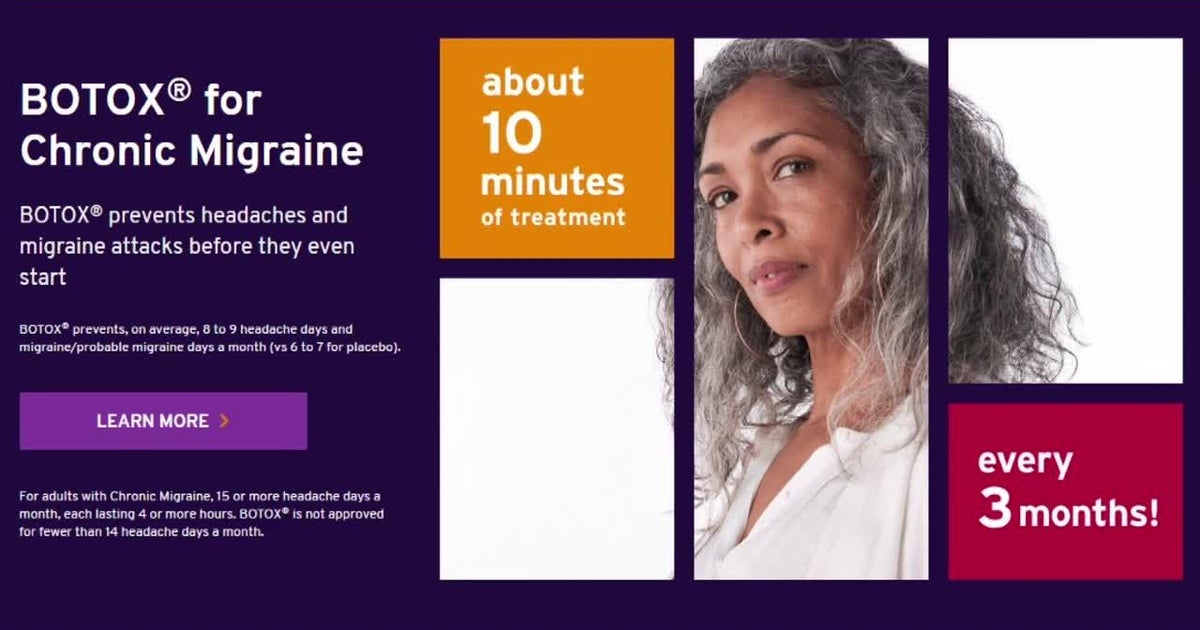 Ask a Doc: Botox for migraines - CBS Baltimore