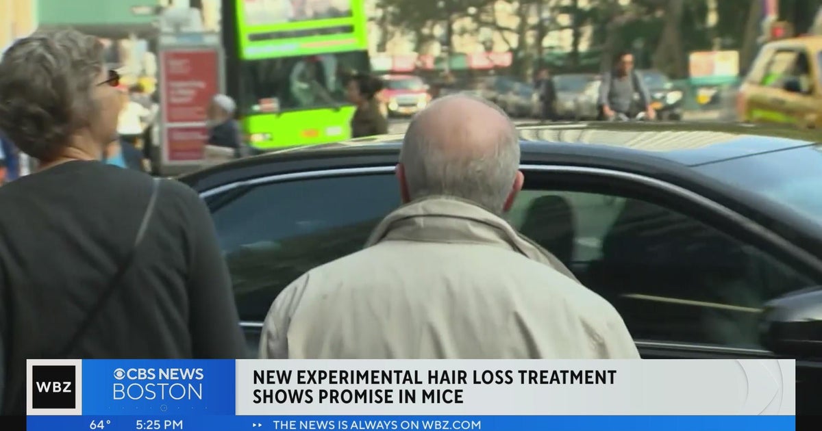 Experimental treatment for hair loss showing promise in mice - CBS Boston