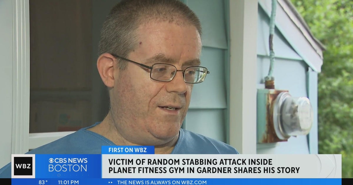 Victim of random Gardner stabbing shares story - CBS Boston Victim of random Gardner stabbing shares story - CBS Boston
