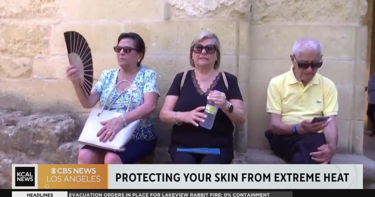 Dermatologist tips for summer skin safety - CBS Los Angeles
