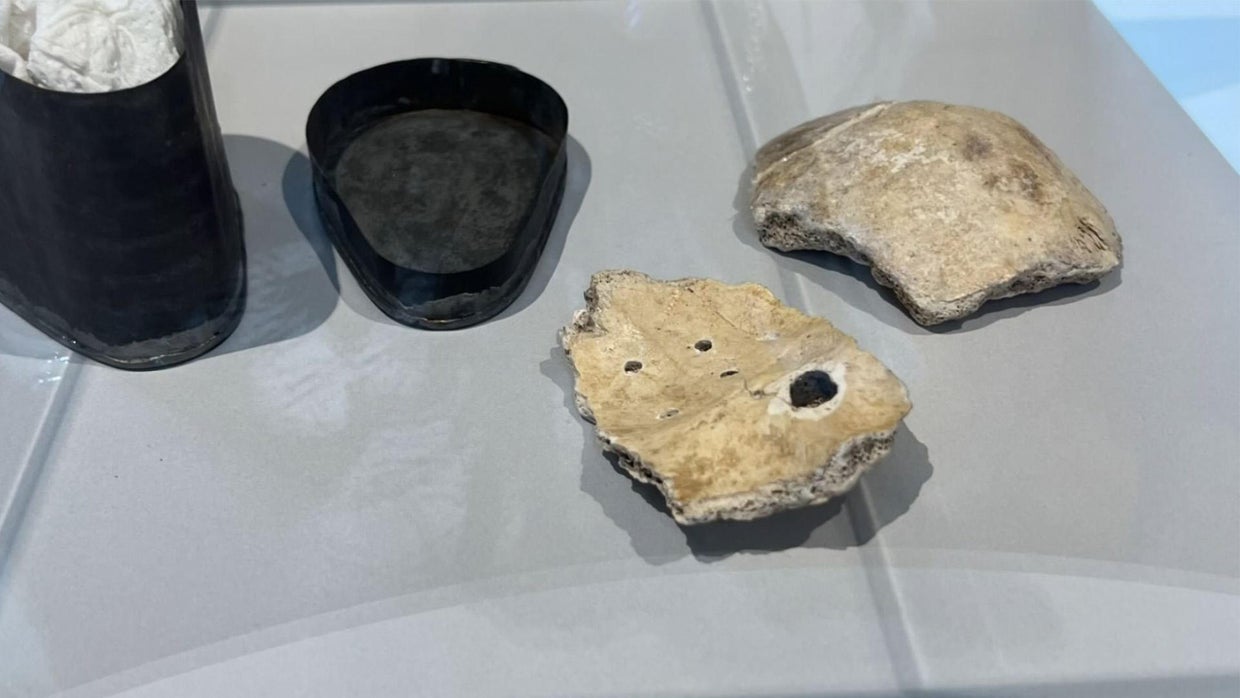 Fragments of what's believed to be Beethoven's skull were in Carmichael ...