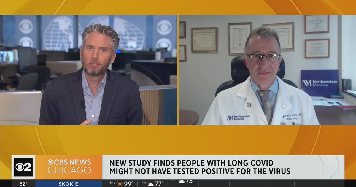 Streaming with Brad: Long Covid study - CBS Chicago