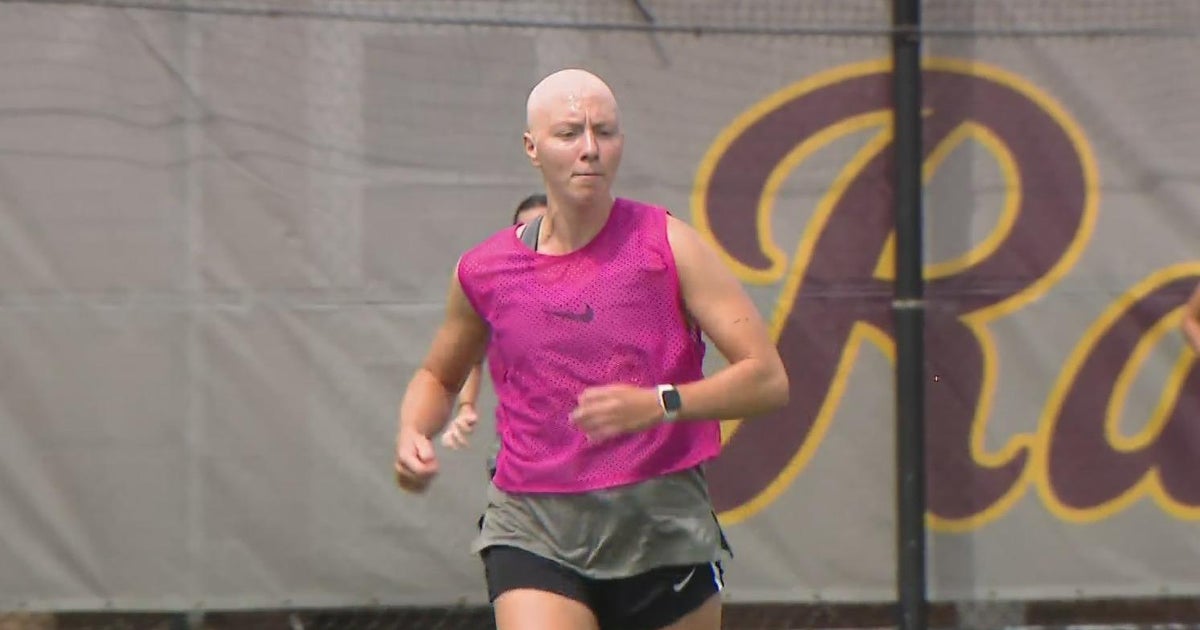 Loyola soccer captain's battle with alopecia inspires teammates - CBS ...