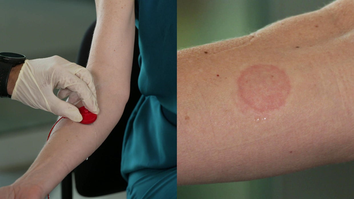 Why you sweat, and why that's a good thing - CBS News