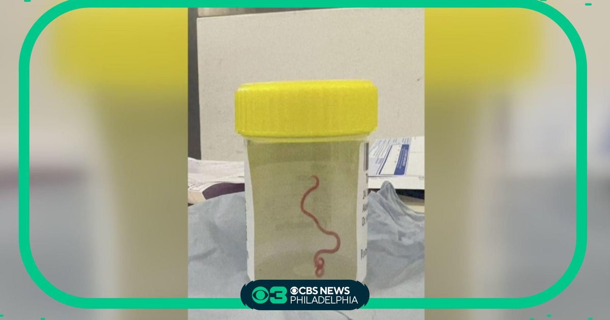 Doctors find live parasitic worm inside an Australian woman's brain ...