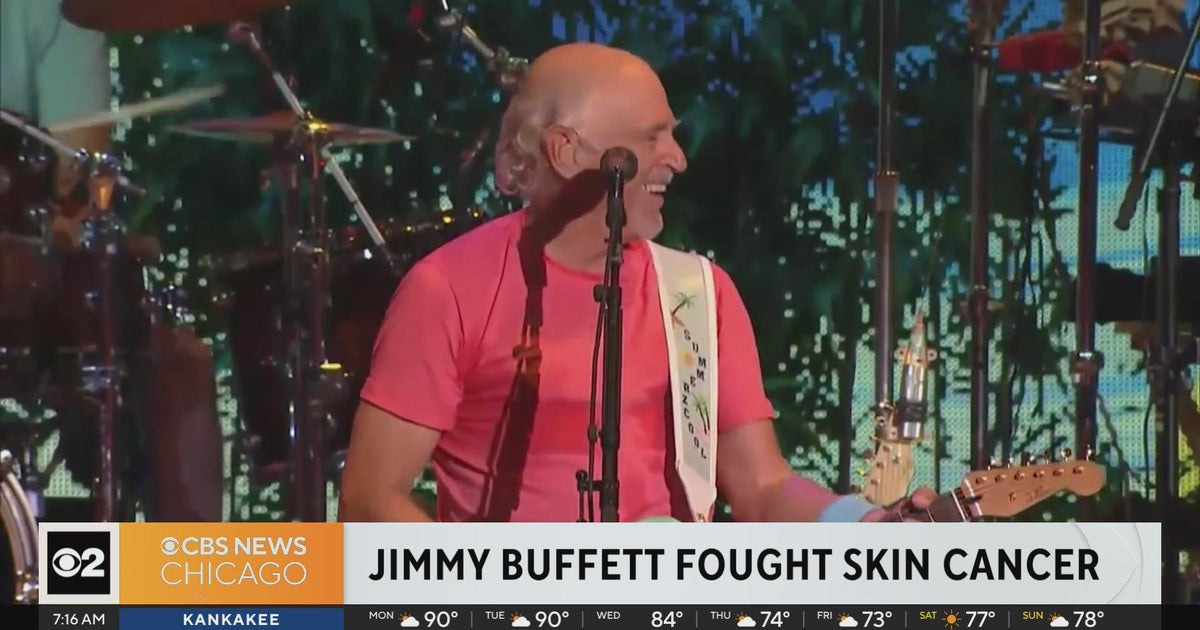Jimmy Buffet fought skin cancer - CBS Chicago