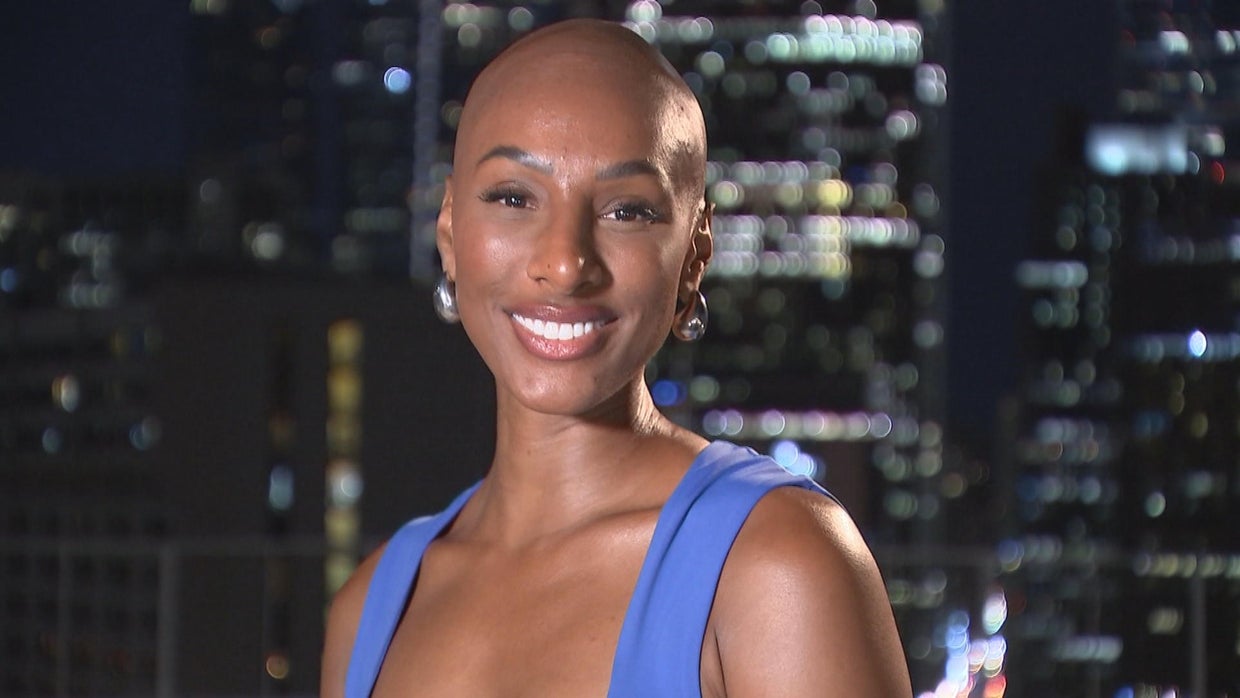 Showing my true self to the world with alopecia: "I wanted to be free ...