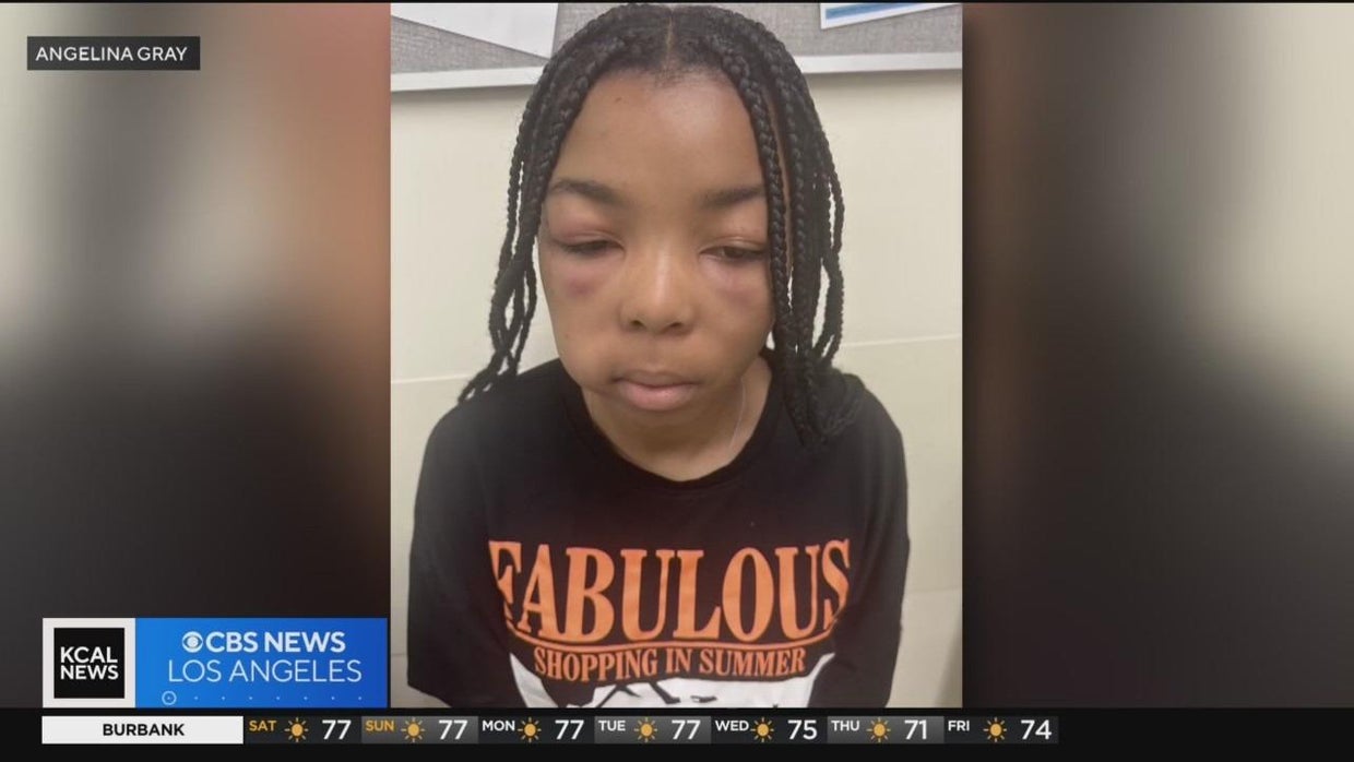 Public calls for woman who attacked teen at Harbor City McDonald's to ...
