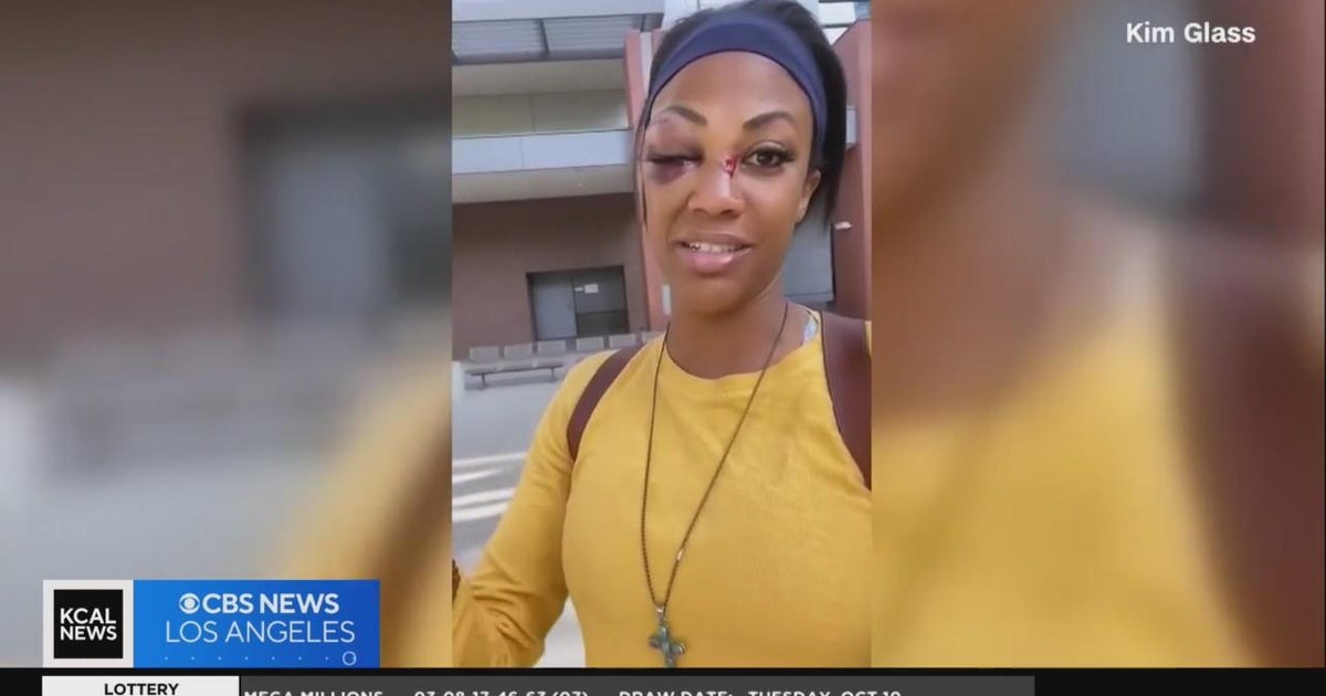 Olympian Kim Glass speaks out after man who attacked her on the street ...