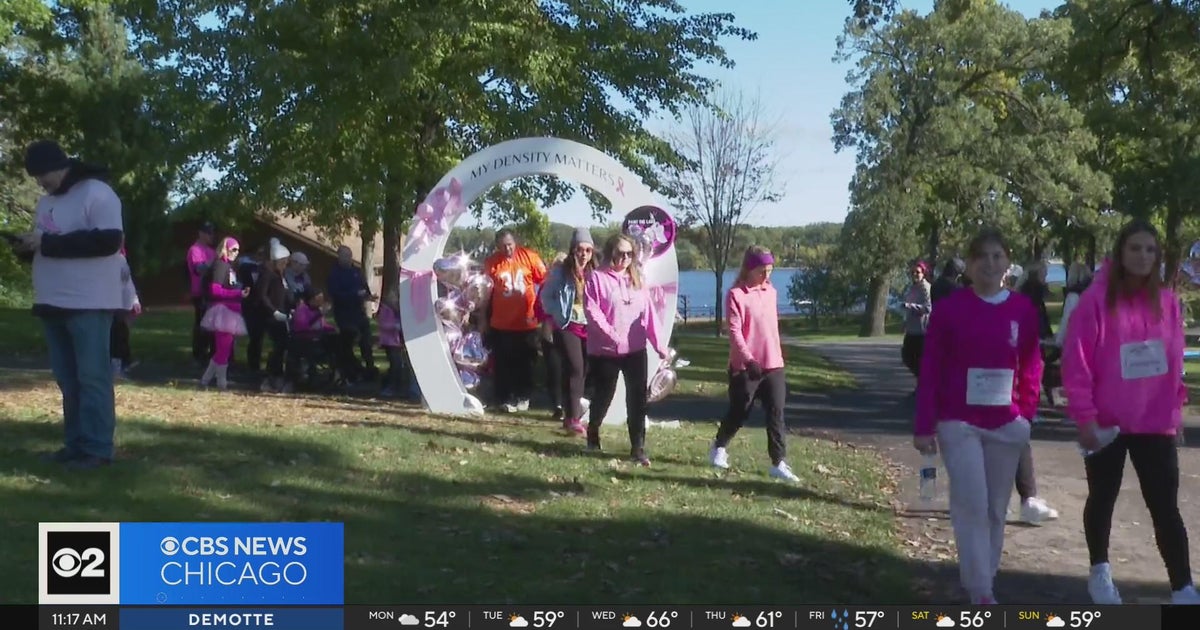For Breast Cancer Awareness Month, breast density - CBS Chicago