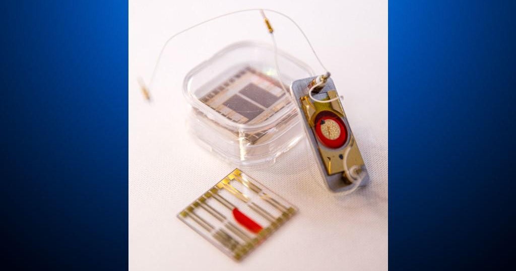 Radiation therapy patch can save cancer patients from collateral damage ...