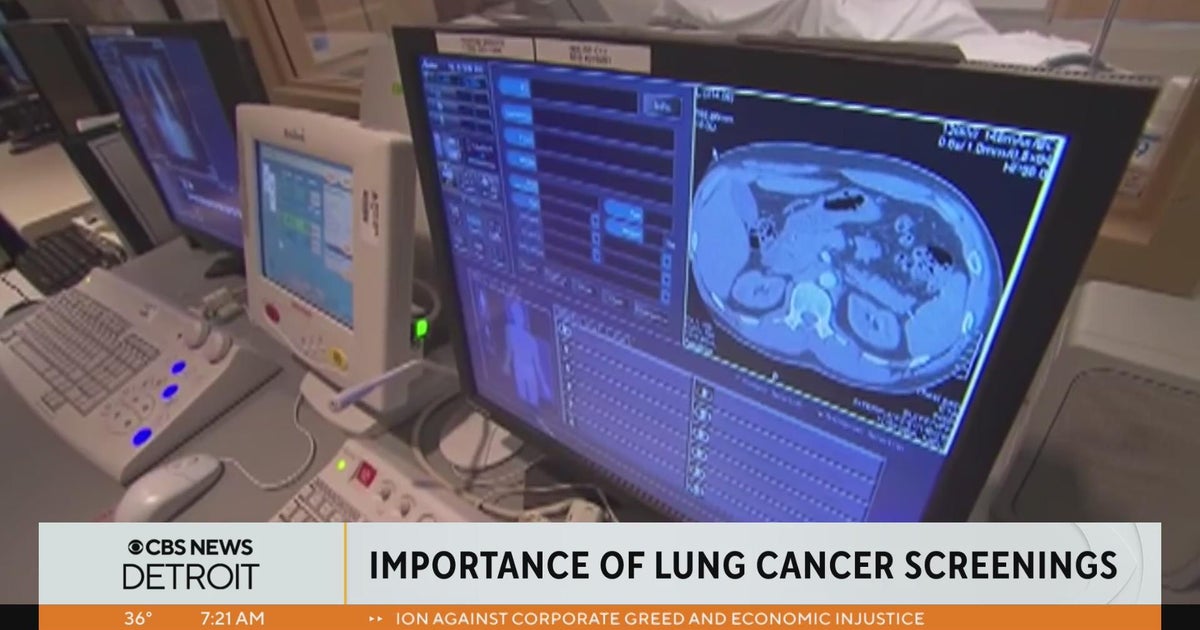 The importance of lung cancer screenings - CBS Detroit