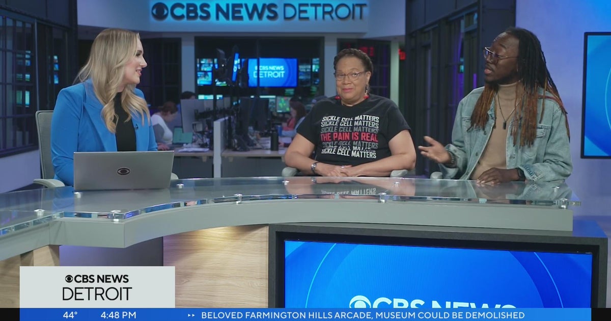 Putting a spotlight on sickle cell anemia - CBS Detroit