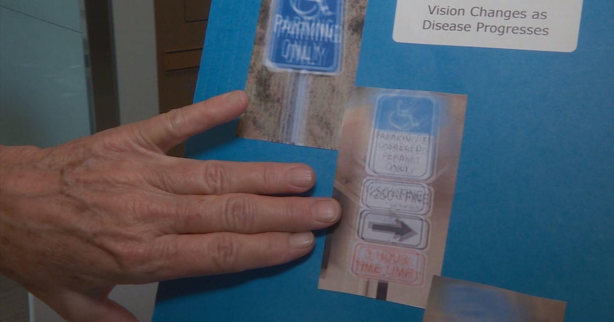 Colorado cornea recipient shares journey, gratitude during Eye Donation ...