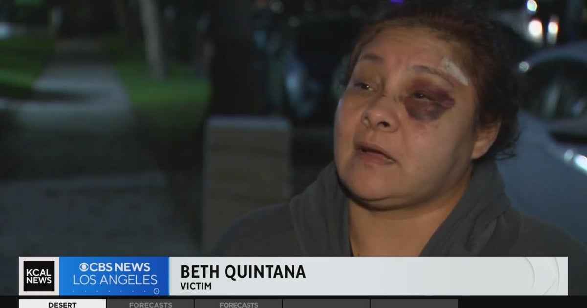 Long Beach woman fights off assault and robbery suspect - CBS Los Angeles